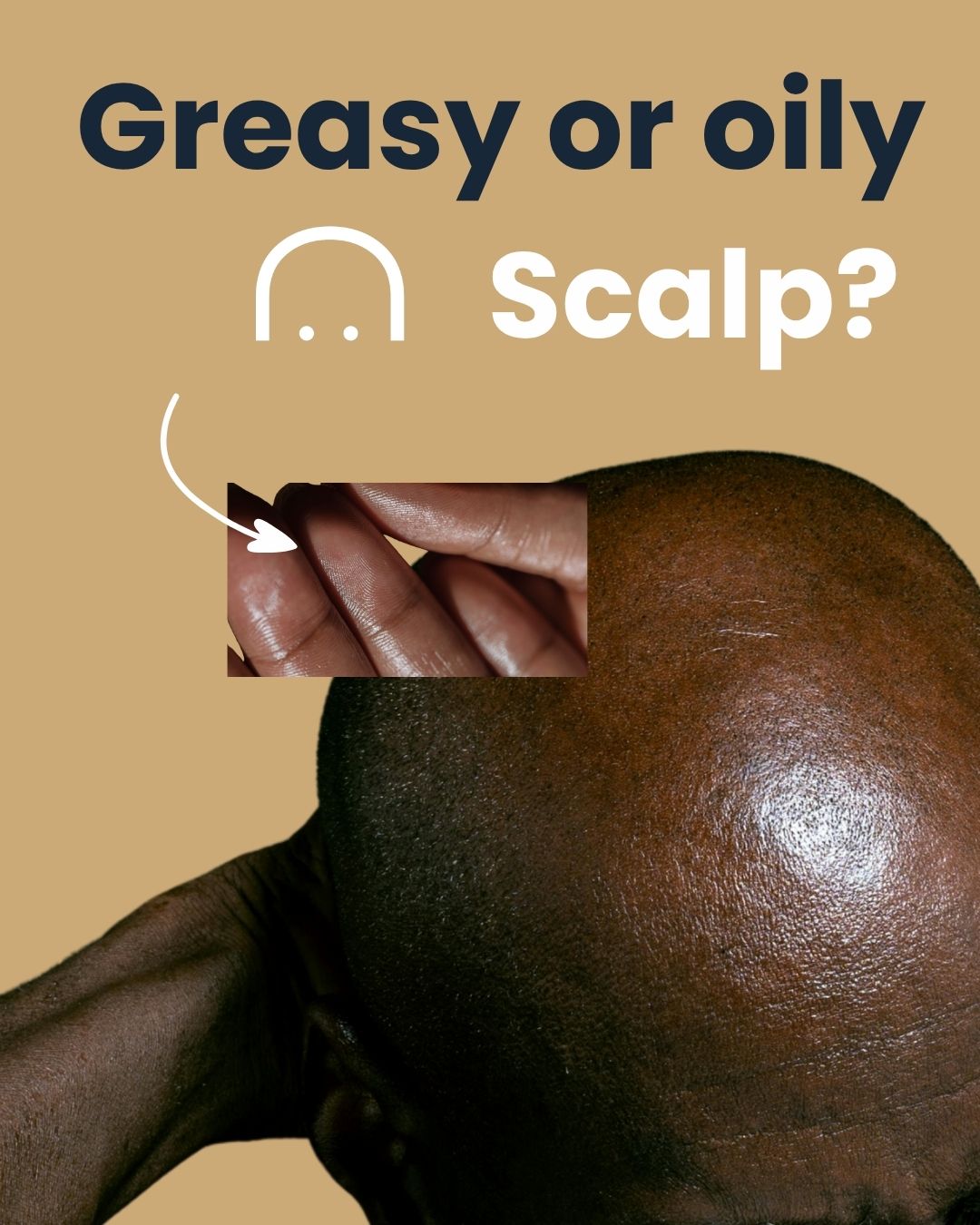 An Oily Scalp on a Bald Head: Causes, Care, and Solutions – Bald&shop