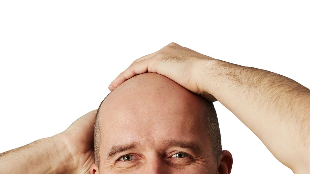 10 Proven Tips to Prevent Bald Head Shine: Keep Your Scalp Smooth and ...